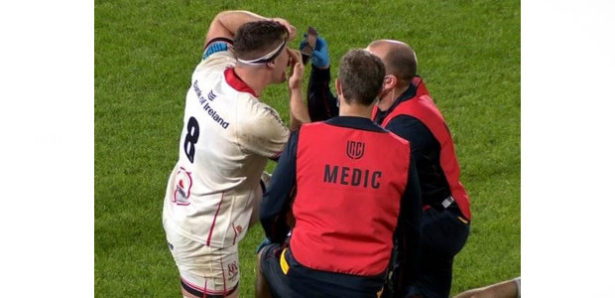 Night Lenses: A Game Changer in Rugby … Night lenses correct your ...